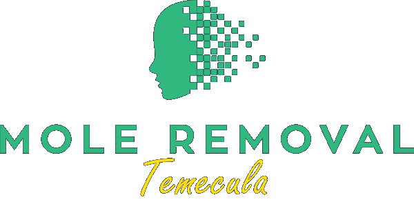 Scarless Mole Removal Temecula | We Remove Moles